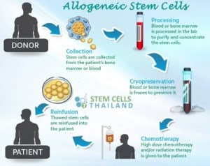 Allogeneic Stem Cells & Allogeneic cell transplantation
