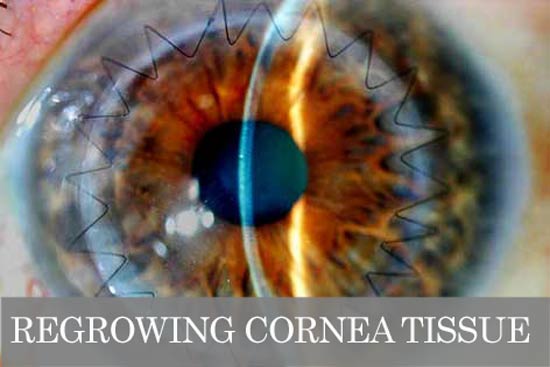 Regenerating Cornea Tissue from Adult Stem Cells
