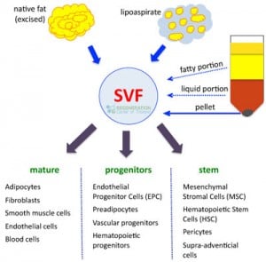 Stromal Vascular Fraction SVF Cells