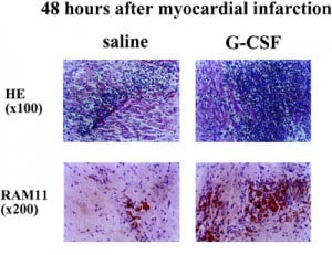 Granulocyte Colony-Stimulating Factor G-CSF Stimulation