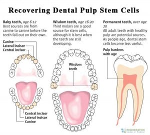 Dental Pulp Derived Stem Cell Extraction,Preservation & Use