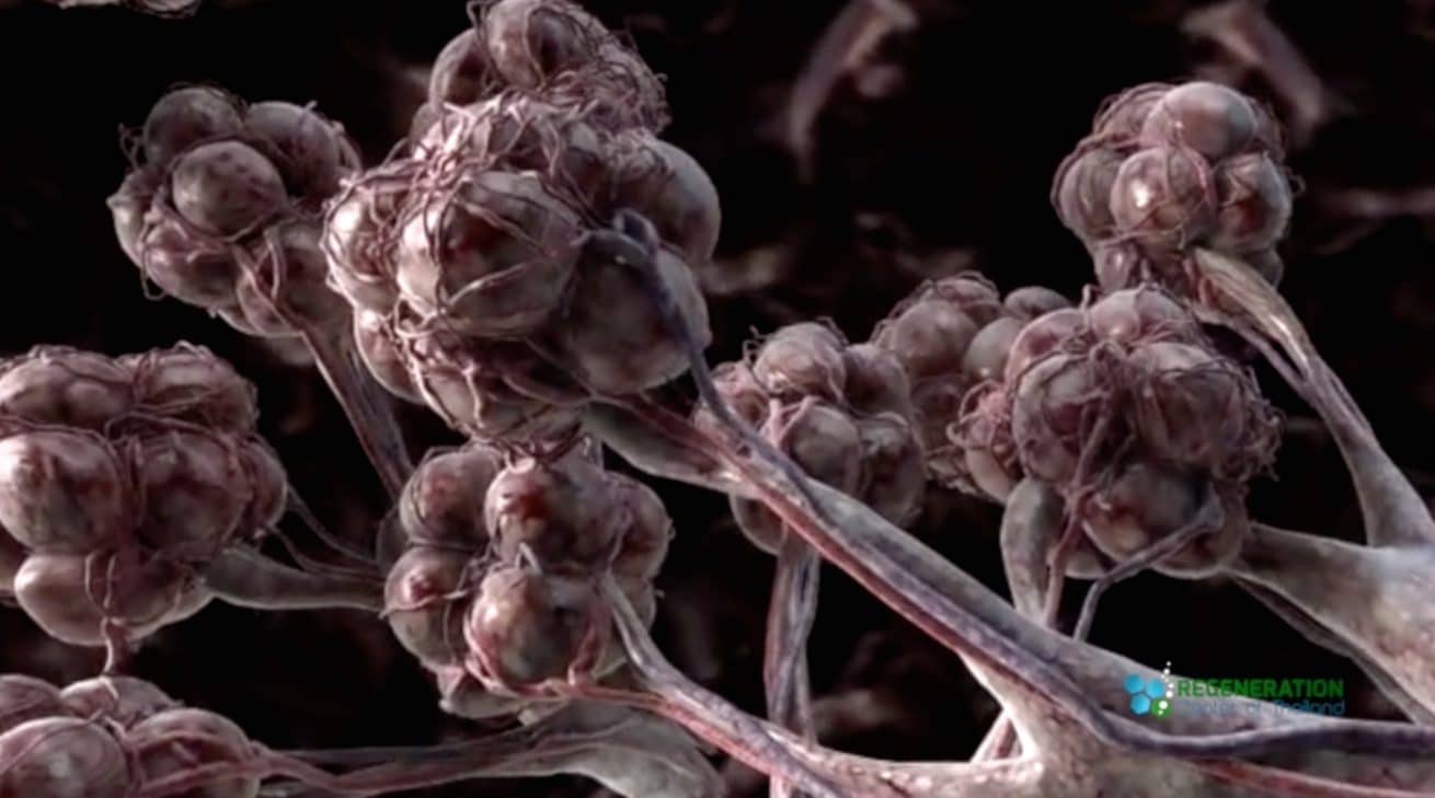 Stem Cell Therapy for Lung Disease & Lung Regeneration