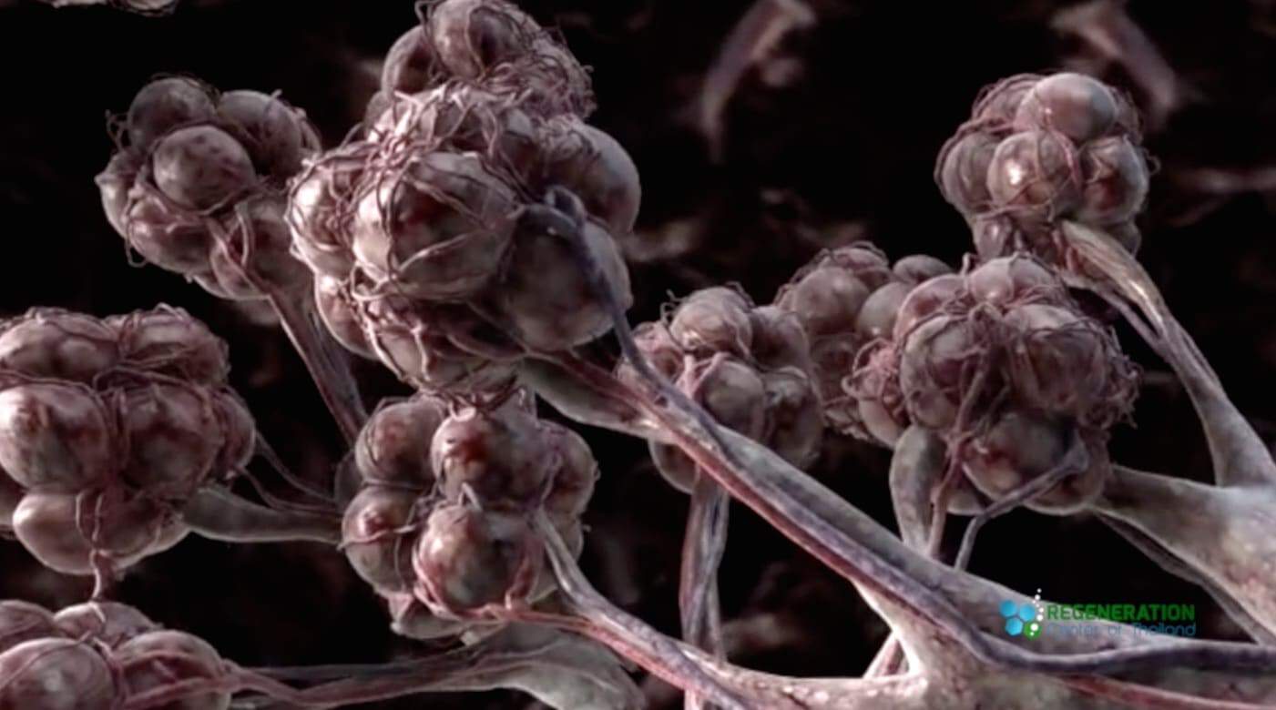 Stem Cell Therapy for Lung Disease & Lung Regeneration