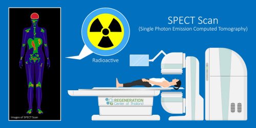 New Radiology Scan Can Identify 30 Types of Cancers
