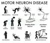 Stem Cell Treatment for Motor Neuron Disease MND
