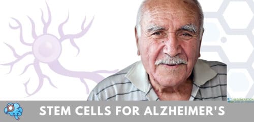 Stem Cell Therapy for Alzheimer’s & Dementia