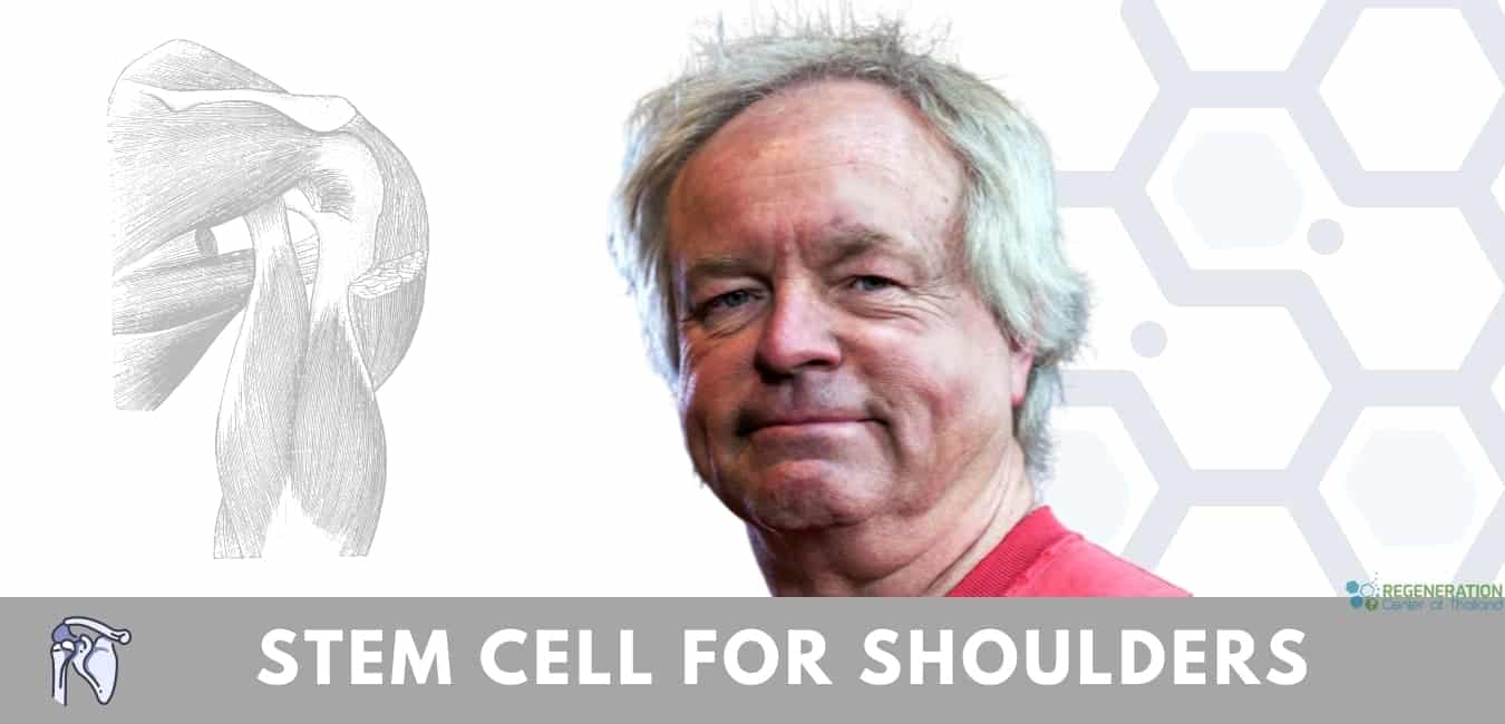 Stem Cells Treatment for Shoulder Injury Arthritis & Labral Tear