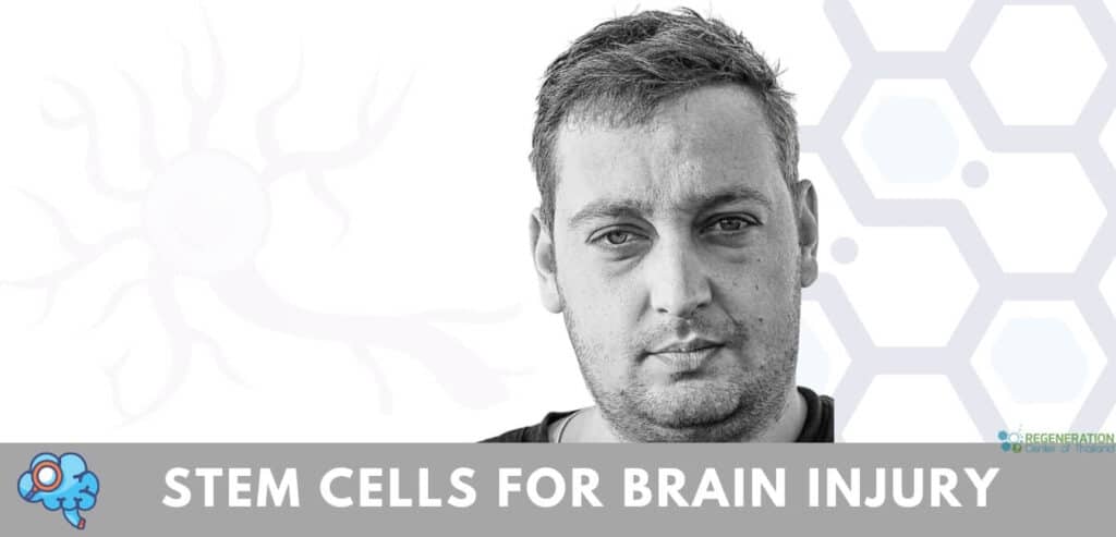 Stem Cell Therapy for Traumatic Brain Injuries CTE & TBI