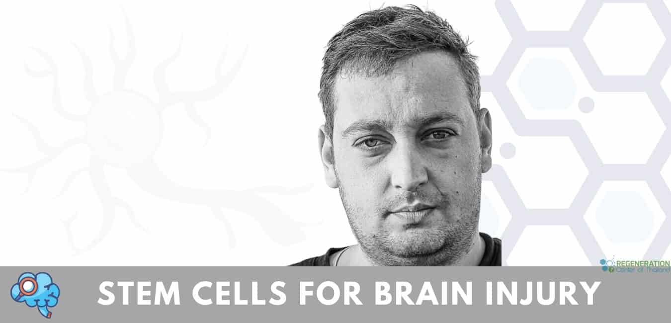 Stem Cell Therapy for Traumatic Brain Injuries CTE & TBI