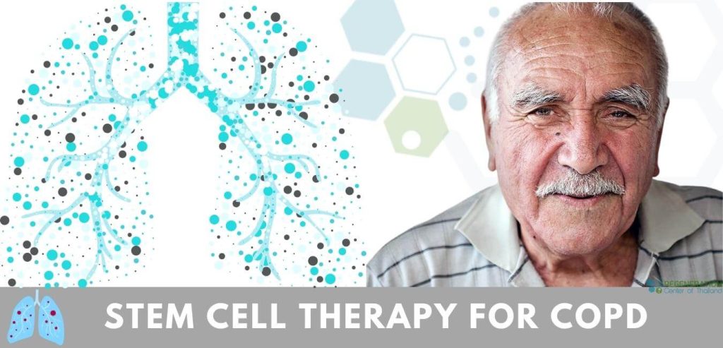 MSC+ Exogenous Stem Cell Therapy for COPD & Emphysema