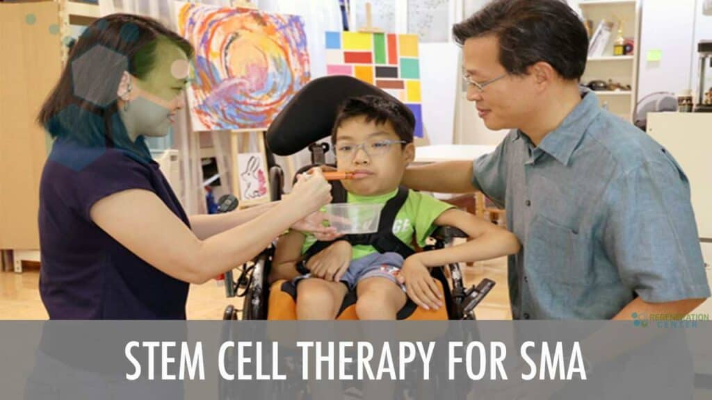 Stem Cell Treatment for SMA - Spinal Muscular Atrophy