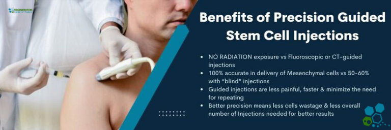 Stem Cell Therapy For Rotator Cuff Instead Of Surgery?