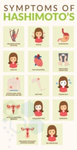 Stem Cell Treatment for Hashimoto’s Disease & Chronic Thyroiditis