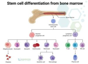 Isolated Bone marrow mesenchymal stem cell transplants - BMSC