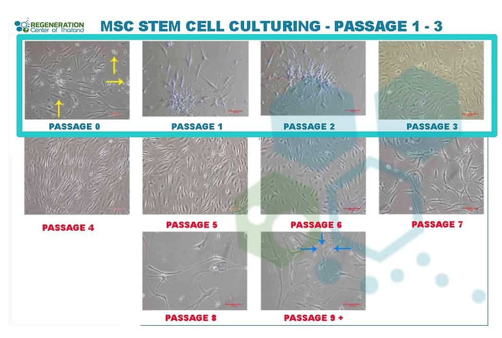 Regeneration Center: A Stem Cell Institution Since 2007