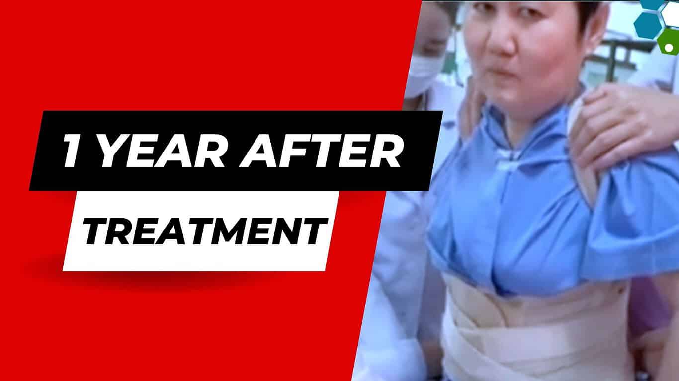 Polar Body Formation Extrusion and Function