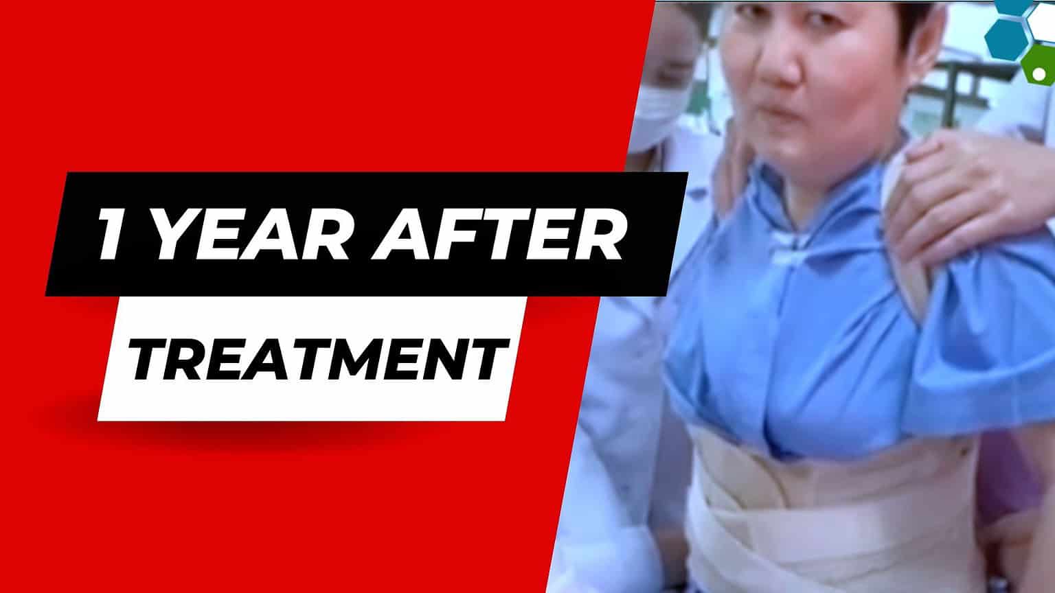 Polar Body Formation Extrusion and Function